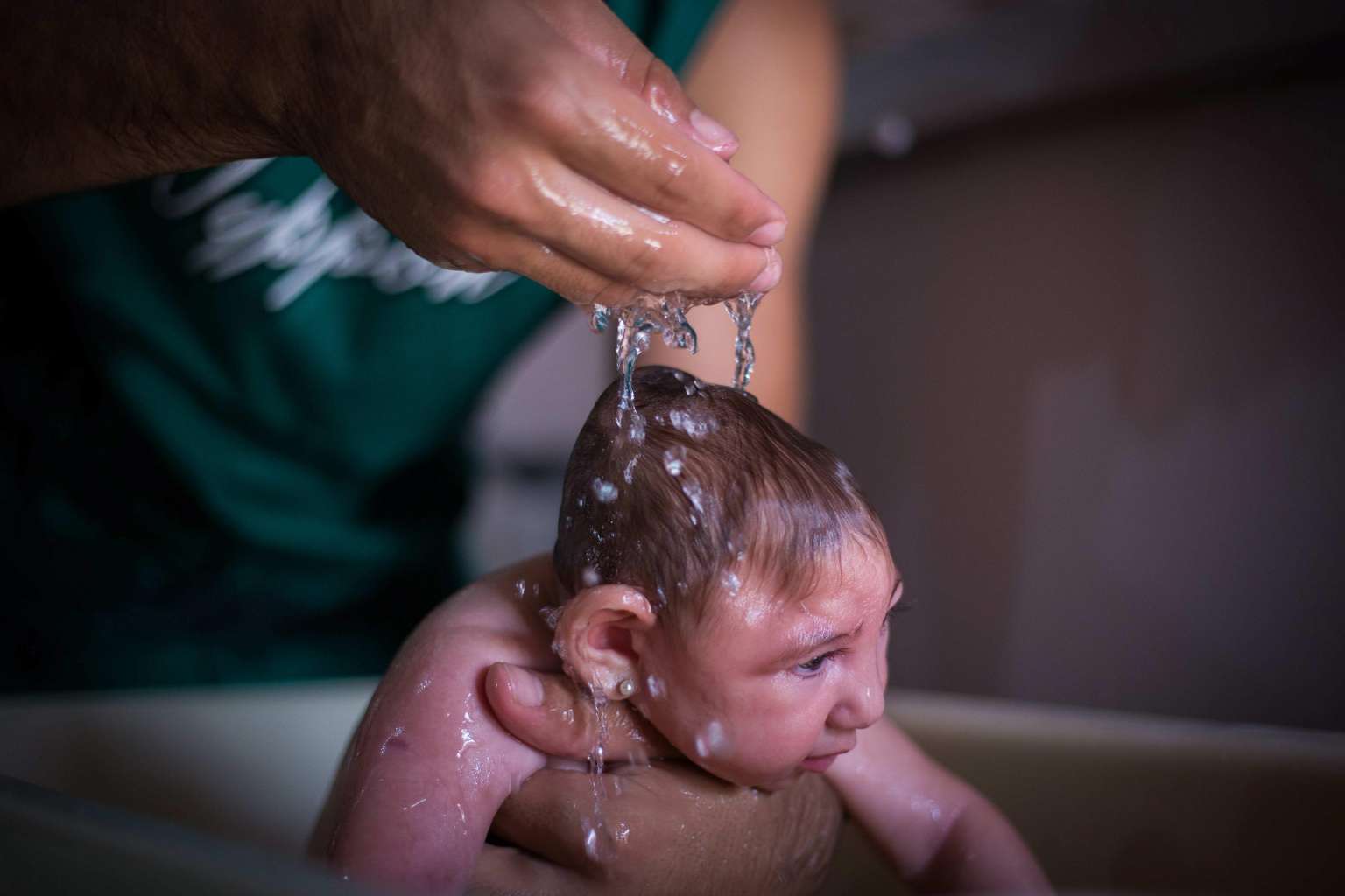 Brazil finds Zika in microcephaly babies' brains | The Straits Times