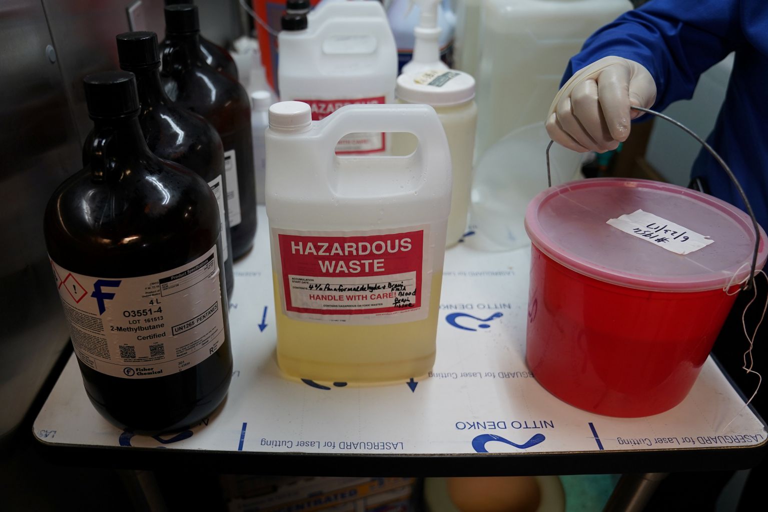 Russian woman 'embalmed alive': What you need to know about formalin ...