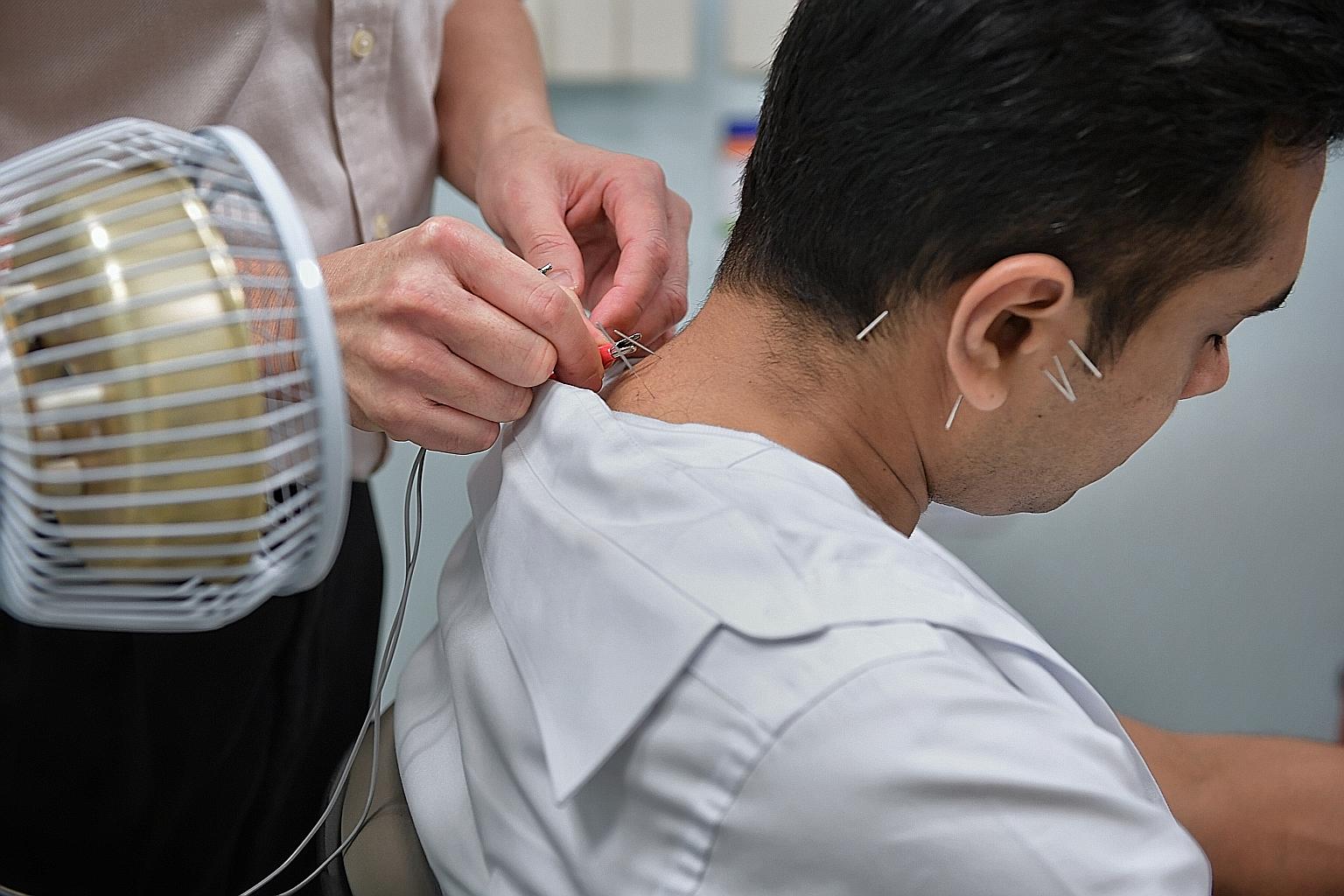 Acupuncture scoring points with hospital patients | The Straits Times