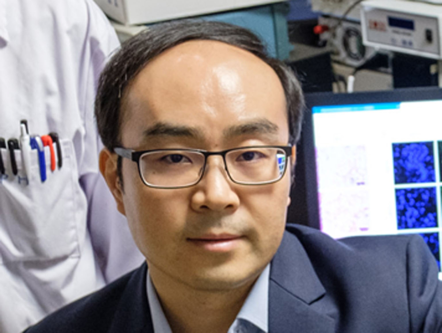 NTU scientists develop probes that can detect acute kidney failure ...