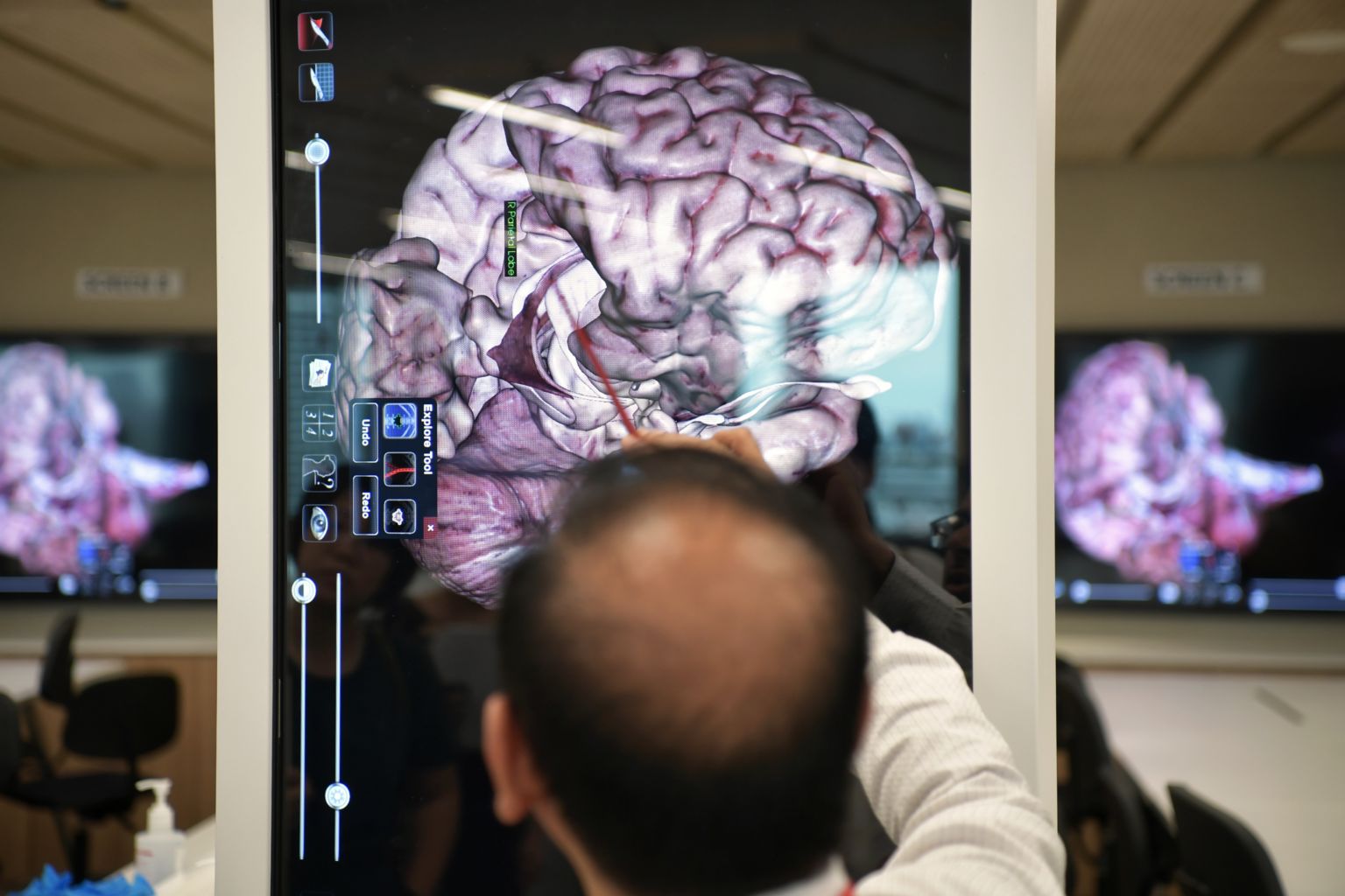 First brain bank in Singapore launched to improve research on Asian ...
