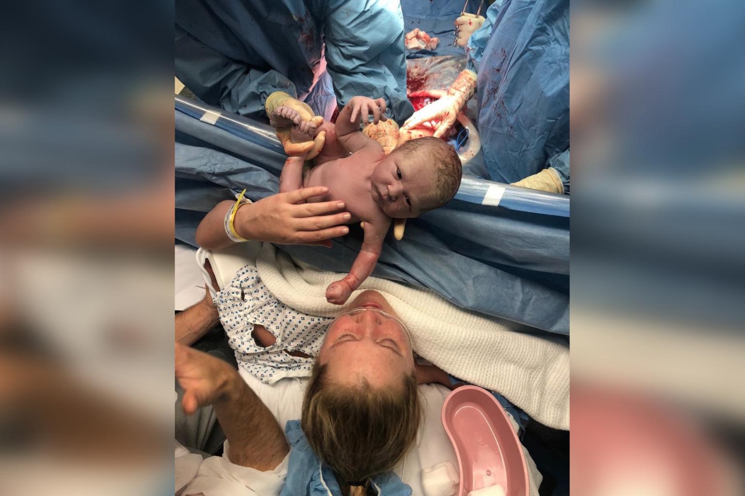 Actress Amy Schumer shares graphic photo of son's birth on National ...