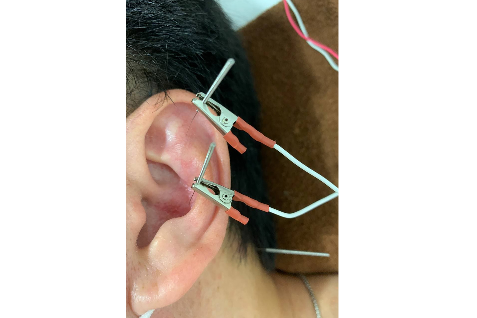 How traditional Chinese medicine can help soothe throat discomfort ...