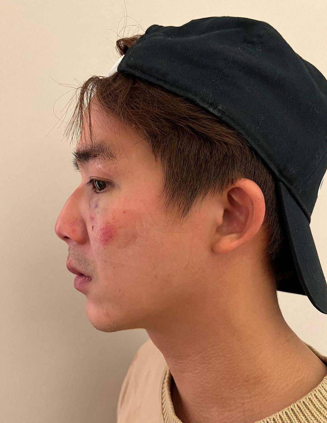Malaysian actor Danny Lee beaten up in Taiwan after he bumped into ...