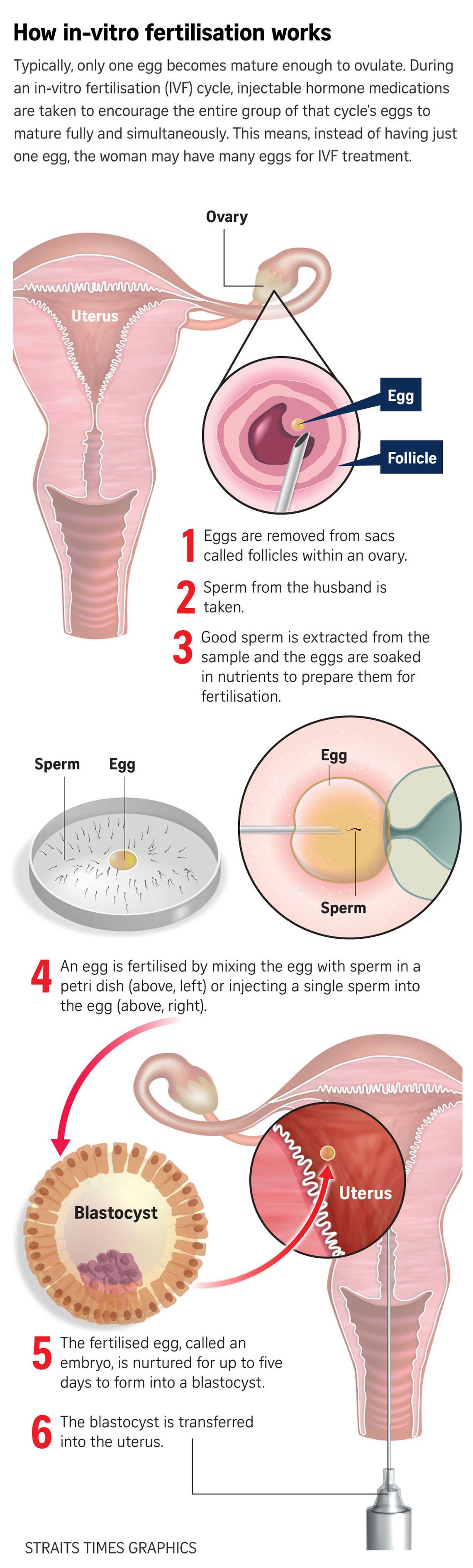 IVF journeys in Singapore: Stories of hope, struggle and determination ...