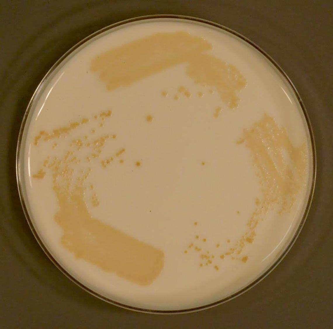 Singapore researchers discover new variant of highly infectious ...