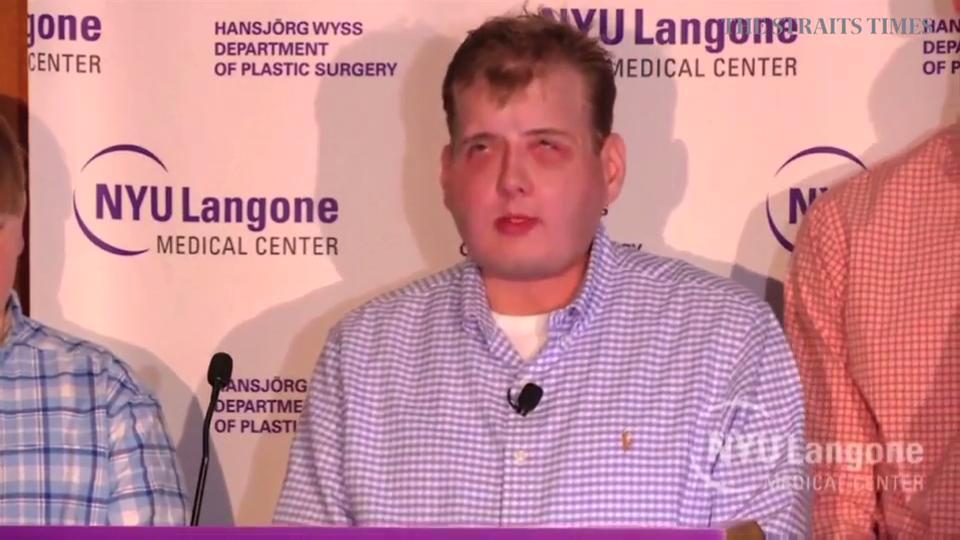 US firefighter disfigured in fire says he feels 'normal' one year after ...
