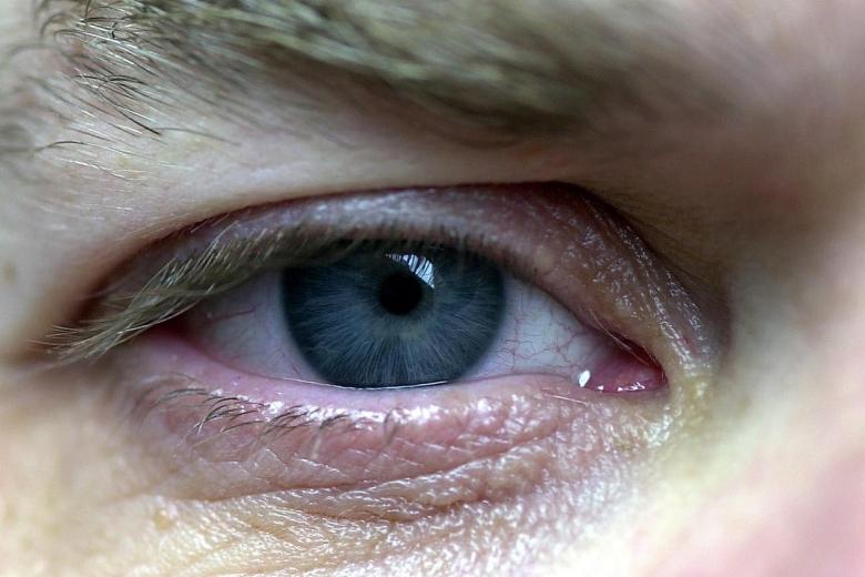 Faulty eye product costs 13 Spaniards their sight: Officials | The ...