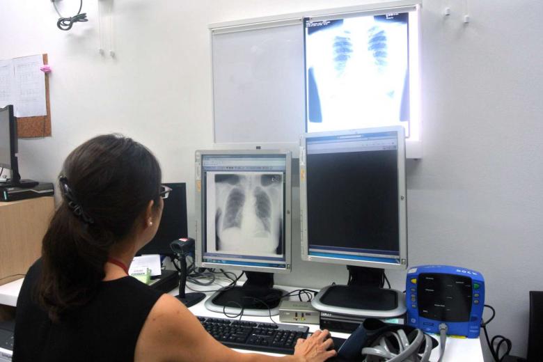 What you need to know about tuberculosis | The Straits Times