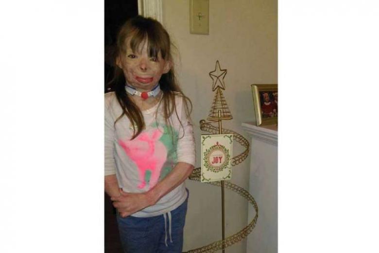 Fire survivor Safyre Terry, 8, gets her Christmas wish, and more | The ...