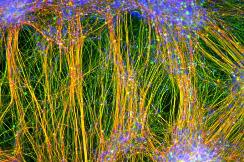 Singapore scientists find way to mass produce neurons using human stem ...