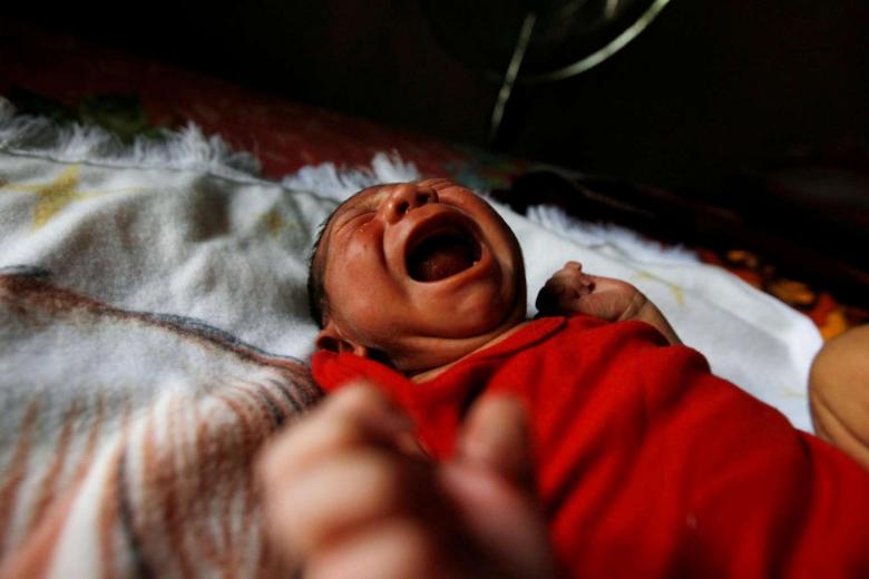Costa Rica registers first microcephaly birth linked to Zika virus ...
