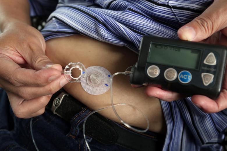 More government help to come for pre-diabetics to stave off diabetes ...