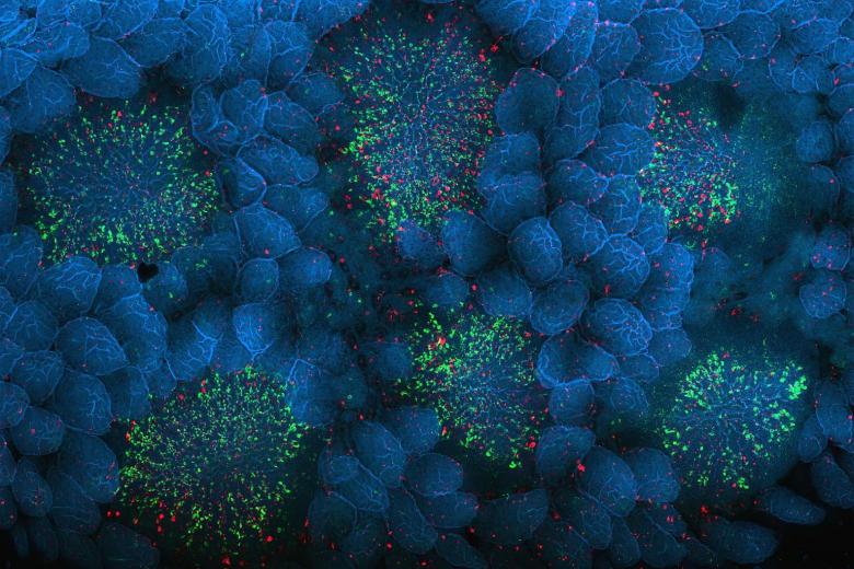 Human form of 'mad cow' disease detectable in skin: Study | The Straits ...