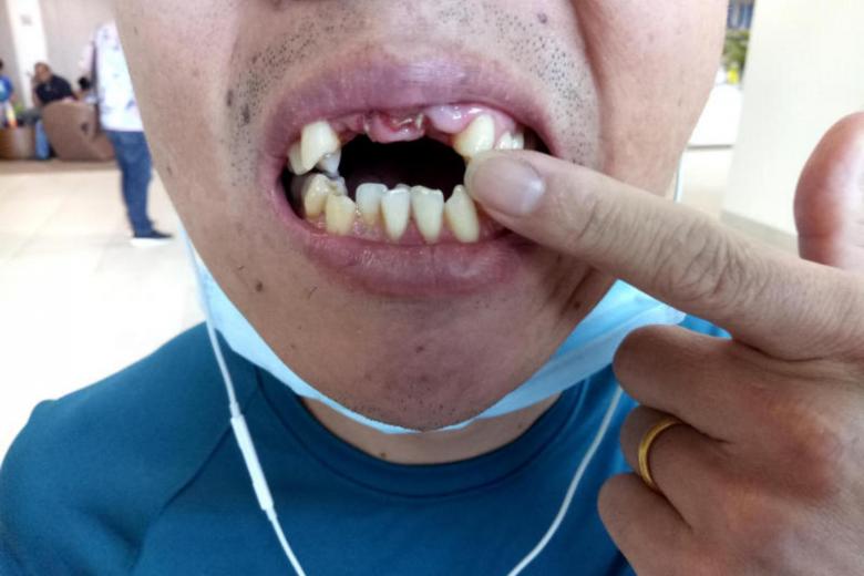 Man fractures 4 teeth after being punched by Grab driver in dispute ...