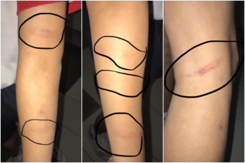 Mother makes police report against primary school after son was caned ...