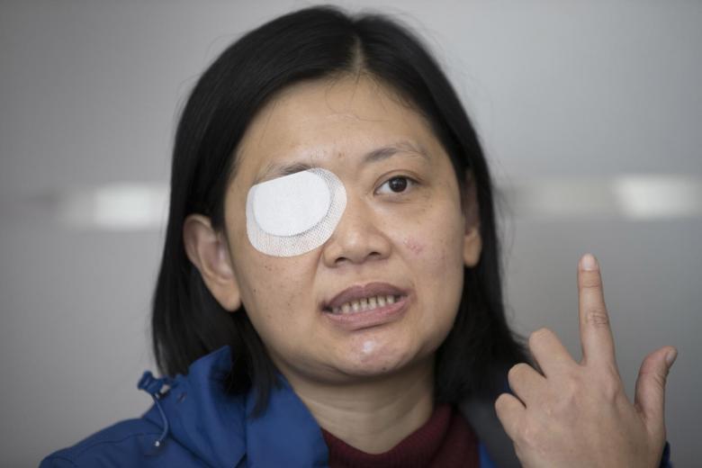 Injured Indonesian journalist seeks answers from Hong Kong police | The ...