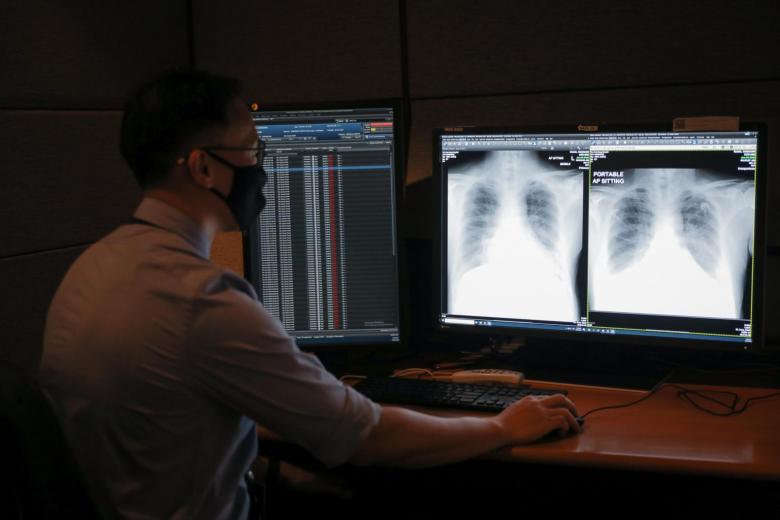 AI-powered tool detects lung infection in chest X-rays quickly during ...