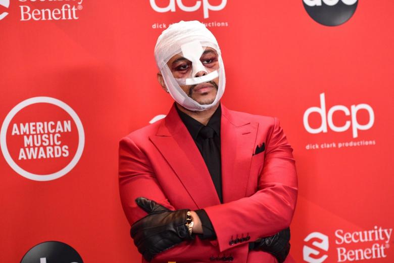 Head bandages a comment on Hollywood culture, says The Weeknd | The ...