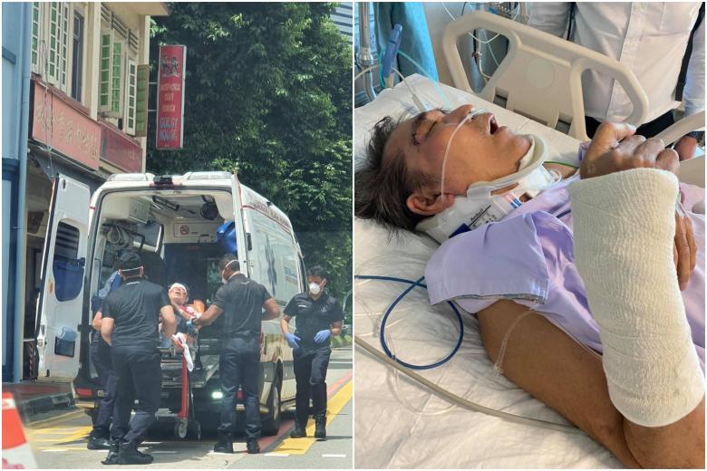 Passenger suffers head injury, punctured lung after SBS Transit bus ...