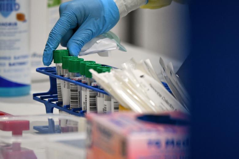 Covid-19: What happens when you test positive? | The Straits Times