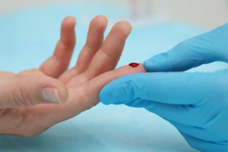 Australian scientists develop finger prick Covid-19 immunity test ...
