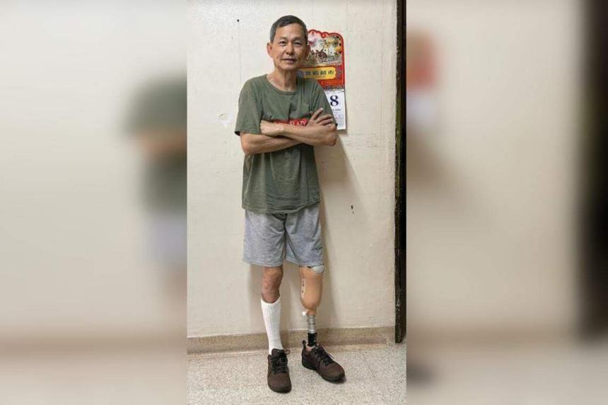 Actor Duan Weiming fitted with prosthetic leg | The Straits Times