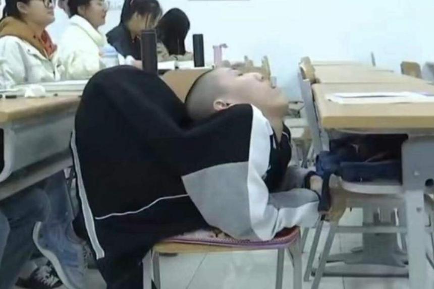 ‘Folded boy’ in China starts surgery in hopes of standing straight for ...