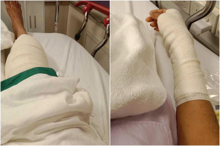 ‘At least it was me and not anyone else’: Animal lover attacked by wild ...