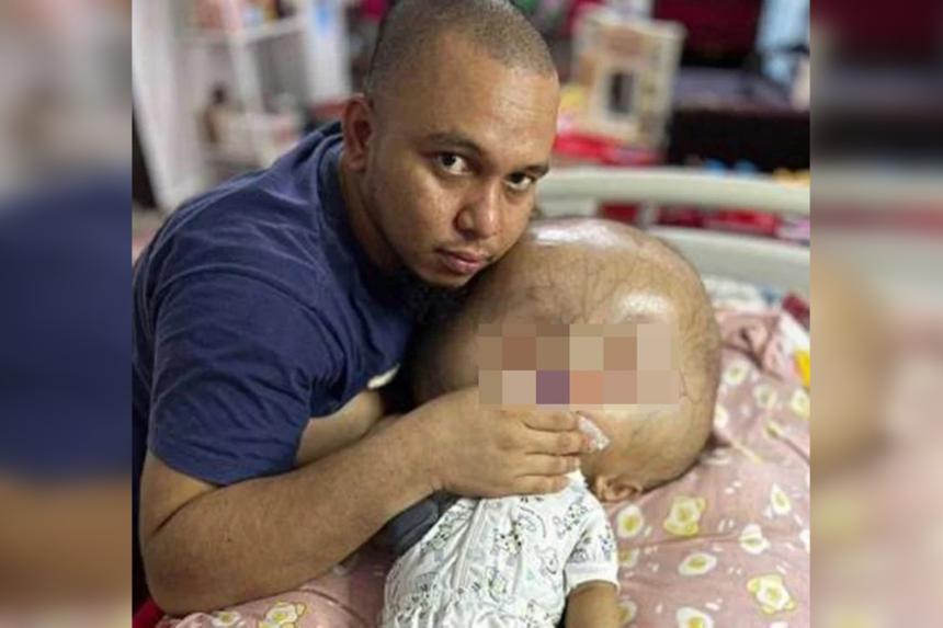 Malaysian boy with head weighing 45kg dies of birth defect | The ...