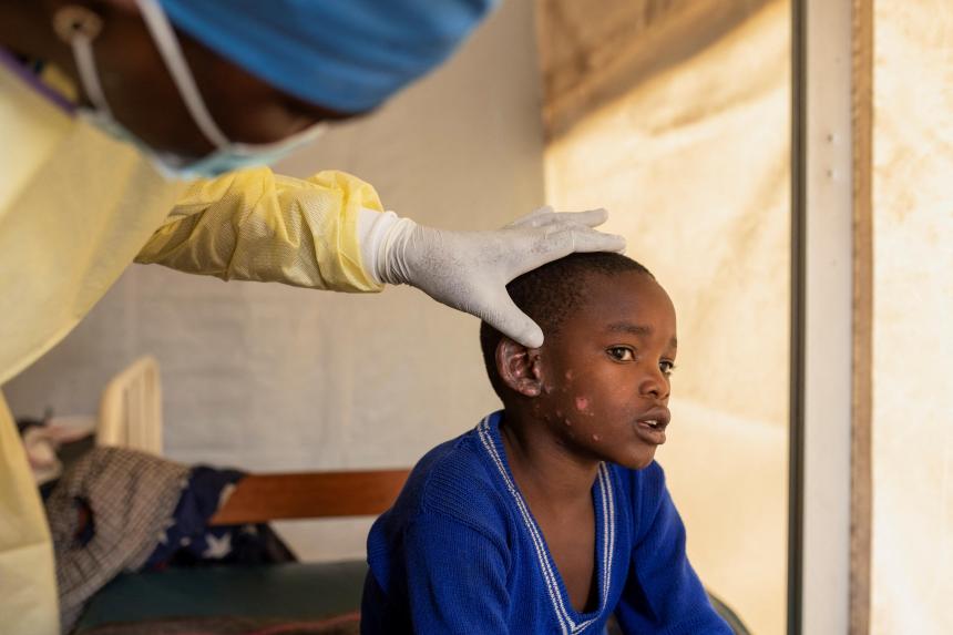 WHO warns of more mpox cases to come in Europe after Sweden case | The ...