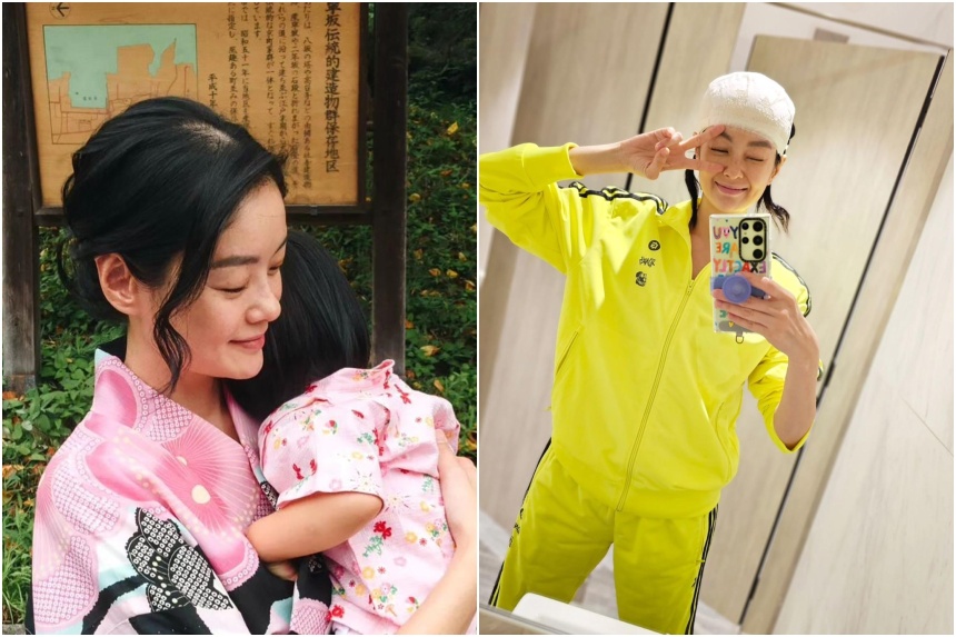 Actress Sheila Sim undergoes hair transplant procedure to fix ...